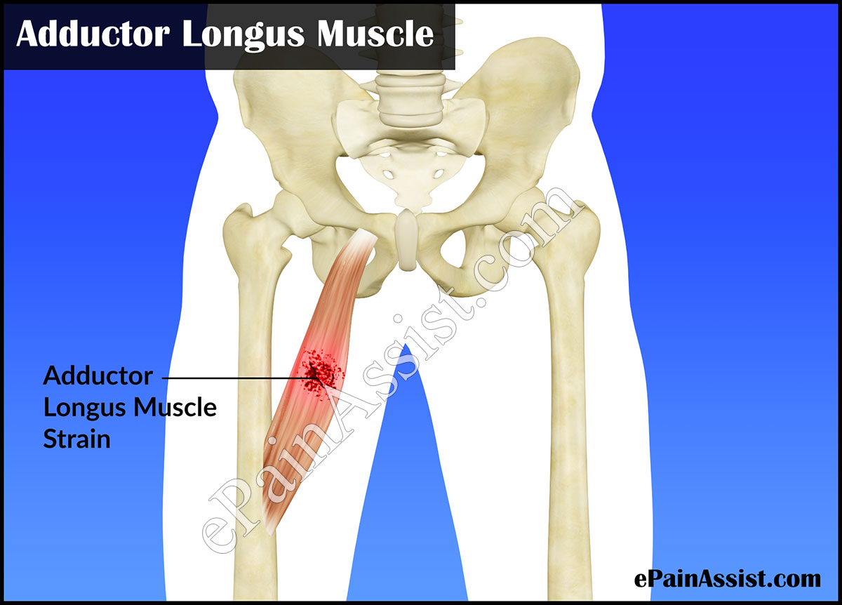 Adductor Longus Strain Causes Symptoms Treatment