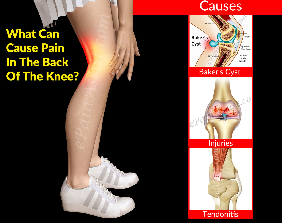 What Can Cause Pain In The Back Of The Knee What Can Cause Pain In The Back Of The Knee
