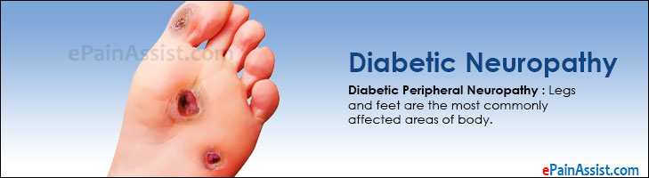 Sugar Diabetes Nerve Damage Jelqing What Is High Blood Sugar In Sugar Diabetes Nerve Damage Jelqing What Is High Blood Sugar In