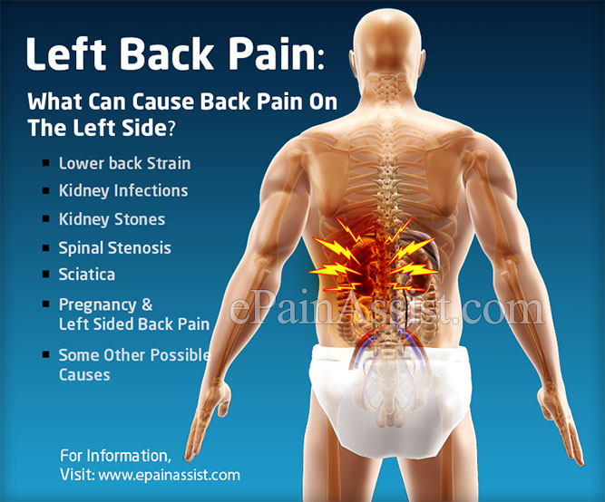 Left Back Pain Symptoms Causes Treatment Prevention Left Back Pain Symptoms Causes Treatment Prevention