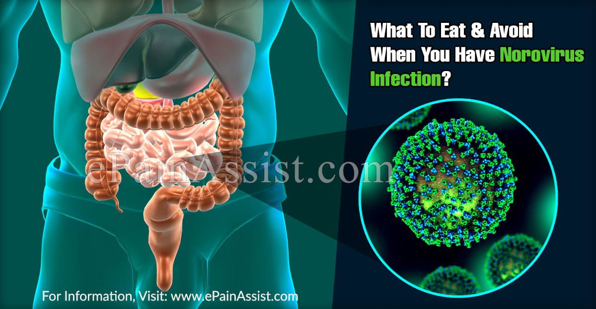 What To Eat Avoid When You Have Norovirus Infection 