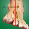 Foot Pain Information Center: Foot Cramps, Foot Joint Dislocation ...