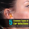 Earache or Ear Pain Information Center: Perforated Eardrum|Ear Piercing ...