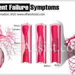 Signs & Stages of Puberty in Boys & Girls