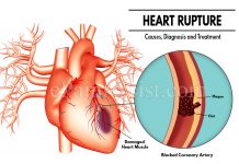 List of heart or cardiac diseases, symptoms