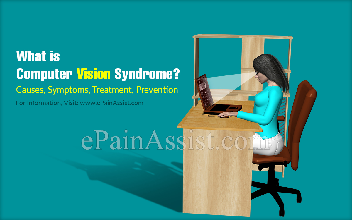 What Is Computer Vision Syndrome Causes Symptoms Treatment Prevention