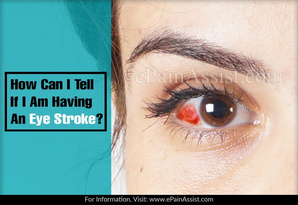 How Can I Tell If I Am Having An Eye Stroke 
