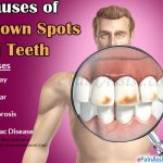 Metabolic Acidosis|Causes|Symptoms|Diagnosis|Treatment|Prognosis|Prevention