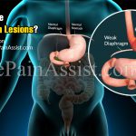 Neck Stiffness: Treatment, Home Remedies, Exercises, Causes