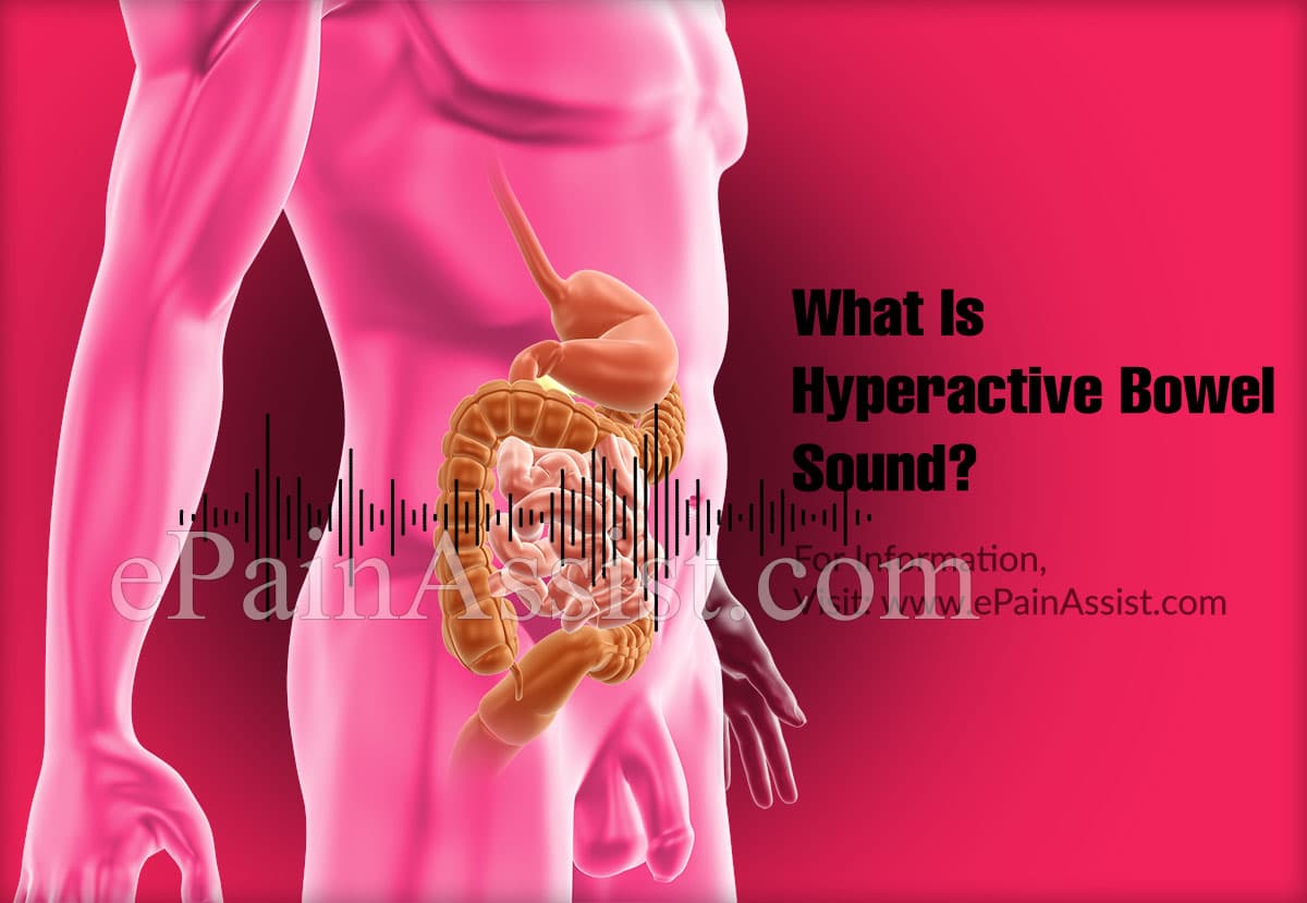 What Is Hyperactive Bowel Sound What Is Its Medical Significance 