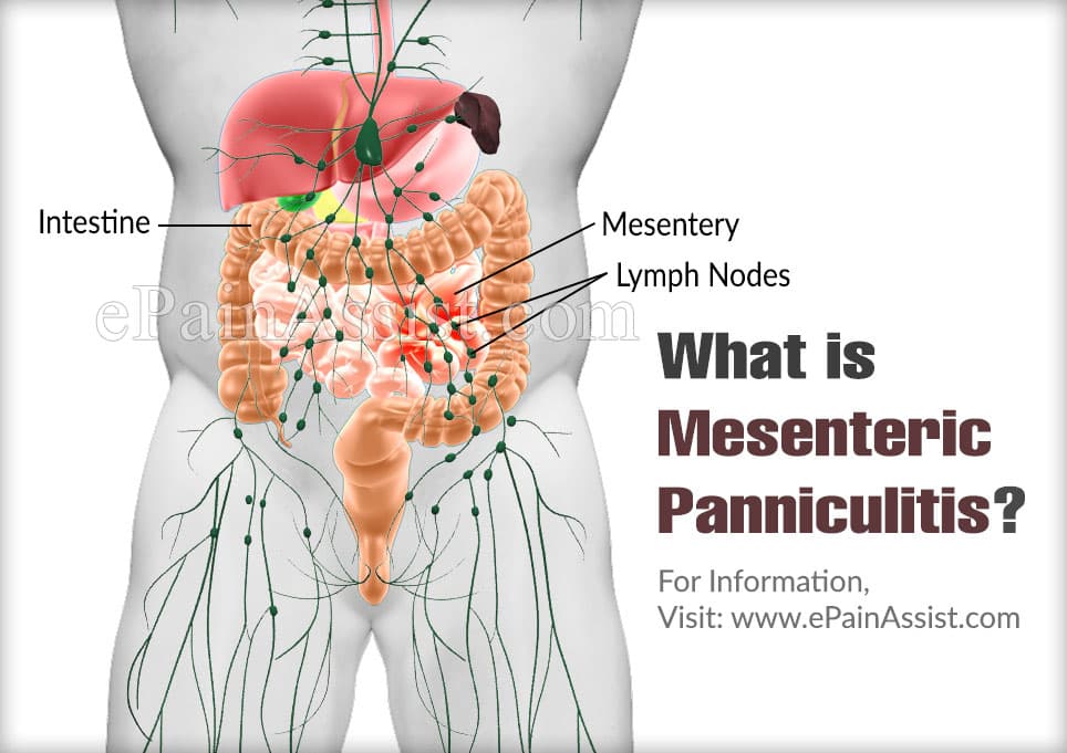 What Causes Mesenteric Panniculitis How Is It Treated 
