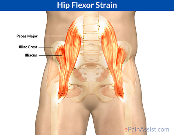Hip Flexor Strain|Types|Causes|Symptoms|Treatment|Exercise|Recovery