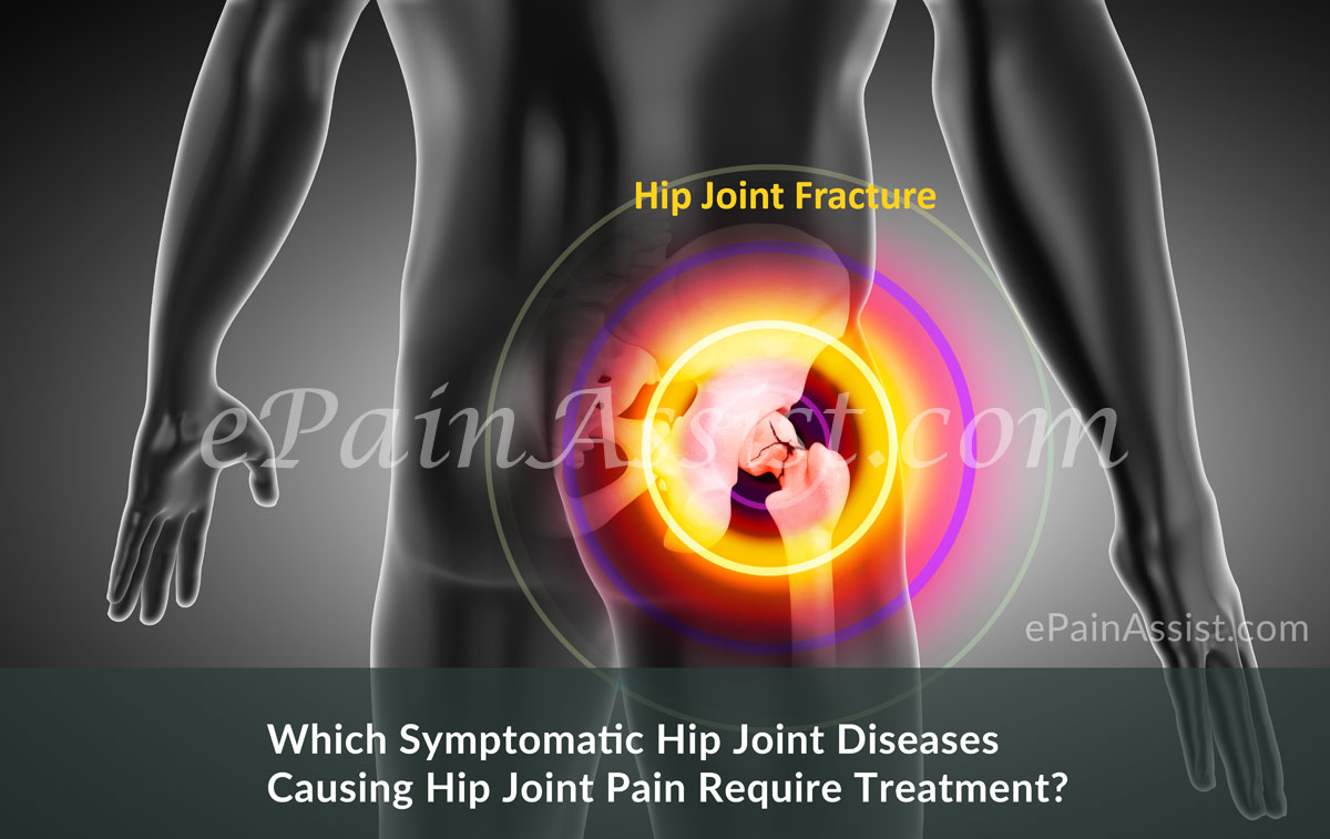 Q&A: Hip Joint Pain Treatment Approach and Options--Everything You Need ...