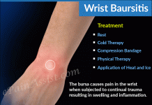 Bursitis|Hip|Shoulder|Ankle Joint|Iliopsoas|Iliopectineal|Infrapatellar ...