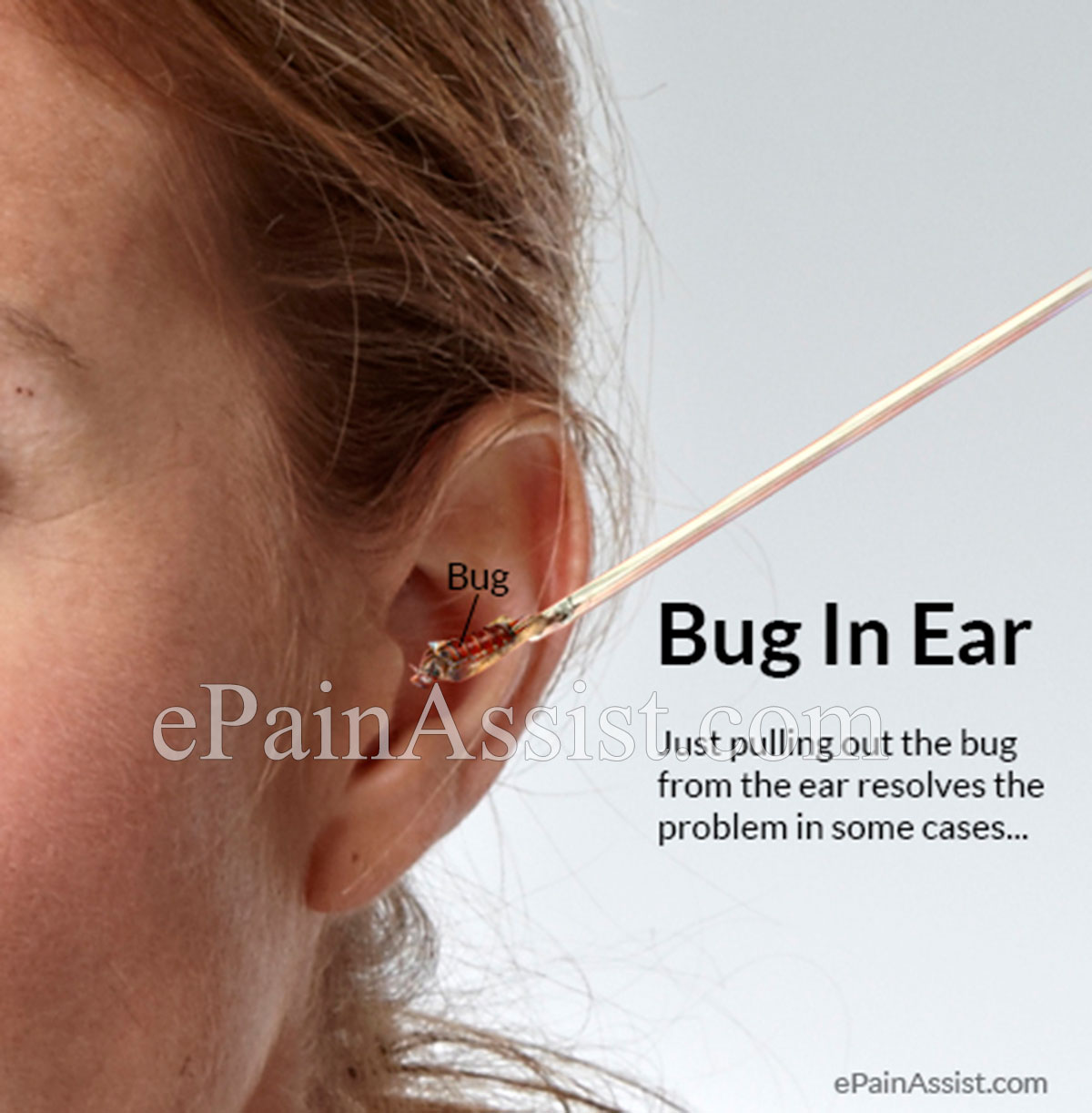 Bug In Ear | 7 Ways To Deal With Ear Pain and Discomfort in Ear