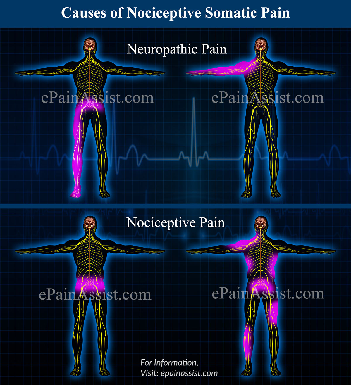 Causes of Nociceptive Somatic Pain | Traumatic Injuries | Blunt Trauma ...