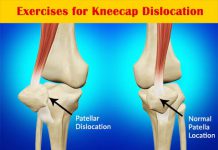 Knee Injuries|Dislocated|Contusion|Sprain|Synovitis|Patellar Dislocation