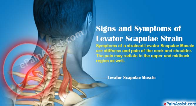 Levator Scapulae Muscle Strain