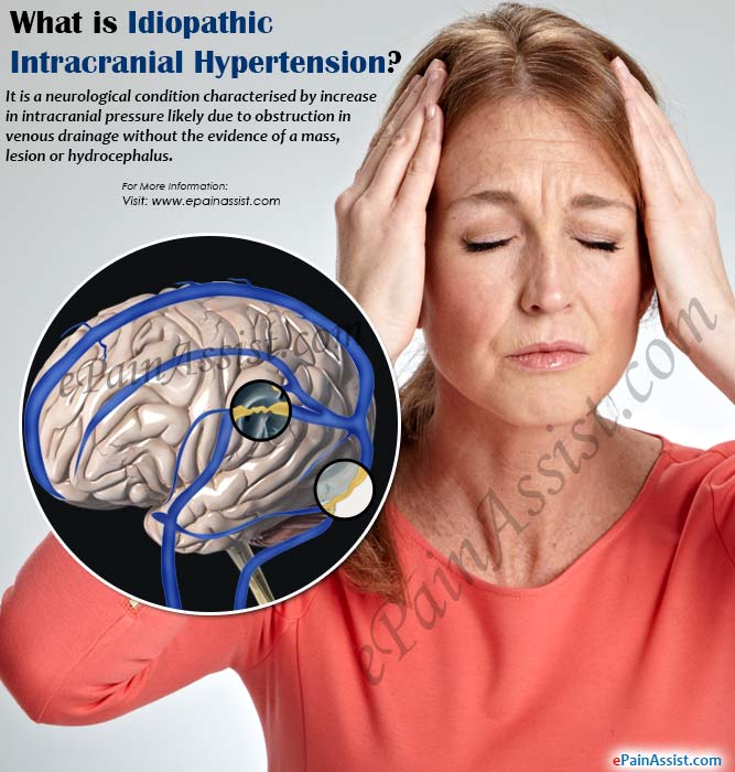 Idiopathic Intracranial Hypertension|Causes|Symptoms|Treatment ...