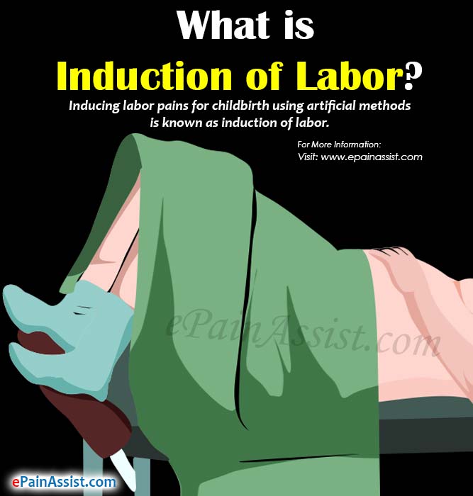 Induction of Labor: Medical Reasons, Methods, Risks and DIY Techniques
