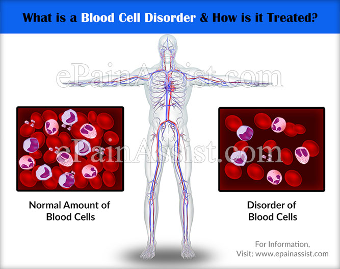 What is a Blood Cell Disorder & How is it Treated?
