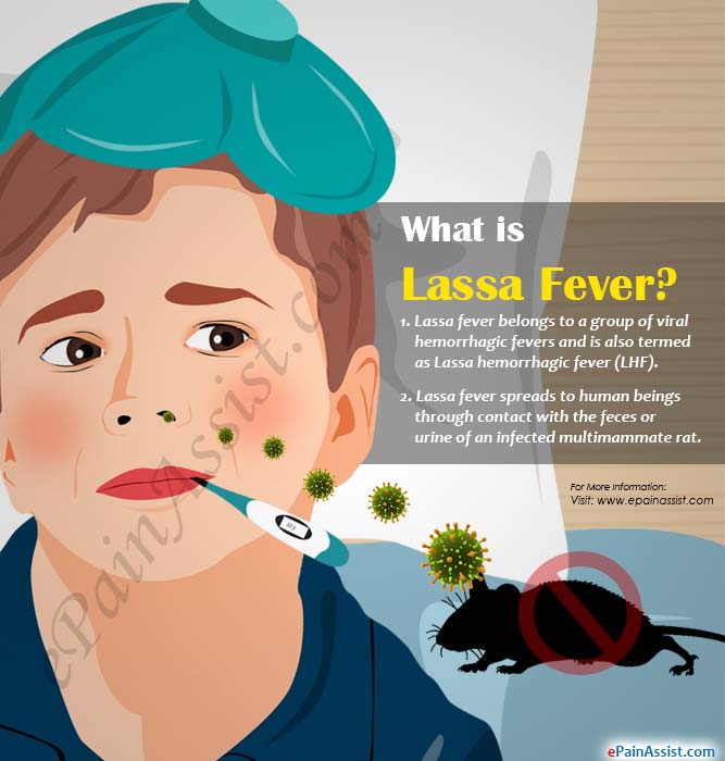 What is Lassa Fever, Know its Causes, Symptoms, Treatment, Prognosis ...