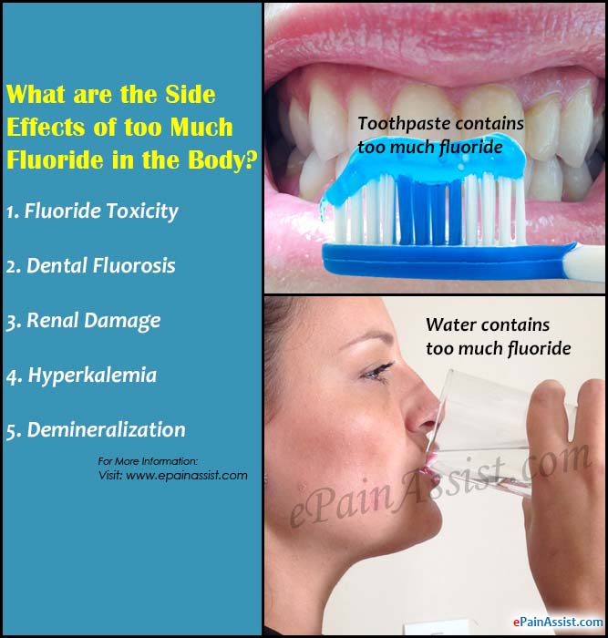 What are the Side Effects of too Much Fluoride in the Body?