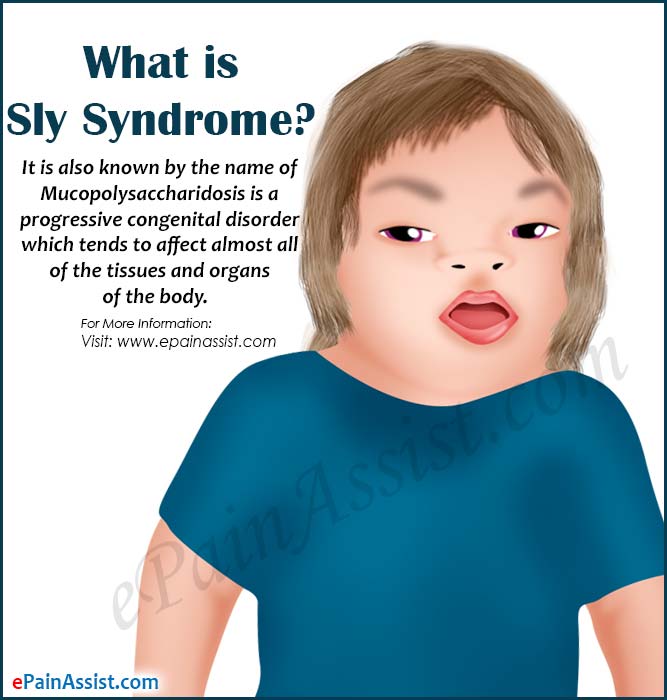 Sly Syndrome|Causes|Symptoms|Treatment|Life Expectancy|Prognosis