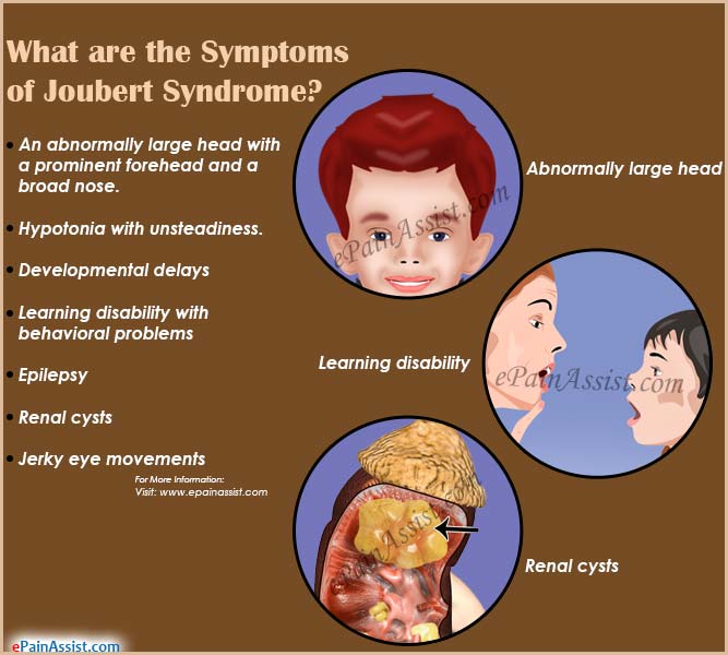 Joubert Syndrome|Causes|Symptoms|Treatment|Prognosis
