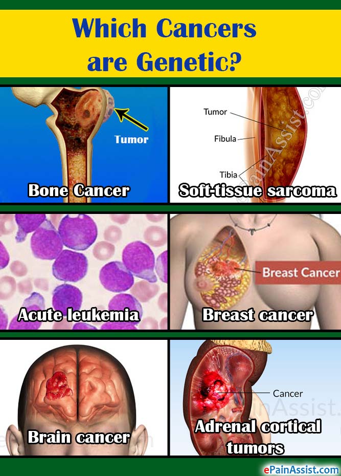 Which Cancers are Genetic & What is a Genetic Cancer, Know the Symptoms ...