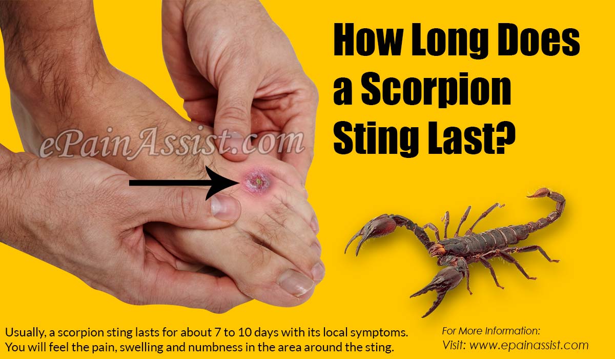 How Long Does A Scorpion Sting Last What To Do If You Get Stung By A