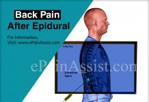 Back Pain Information Center: Upper, Mid, Low Back Pain-Symptoms, Treatment