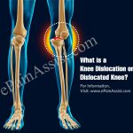 What to do for Frostbite?