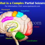 What is Cerebellar Tonsillar Ectopia?|Symptoms|Causes|Diagnosis|Treatment