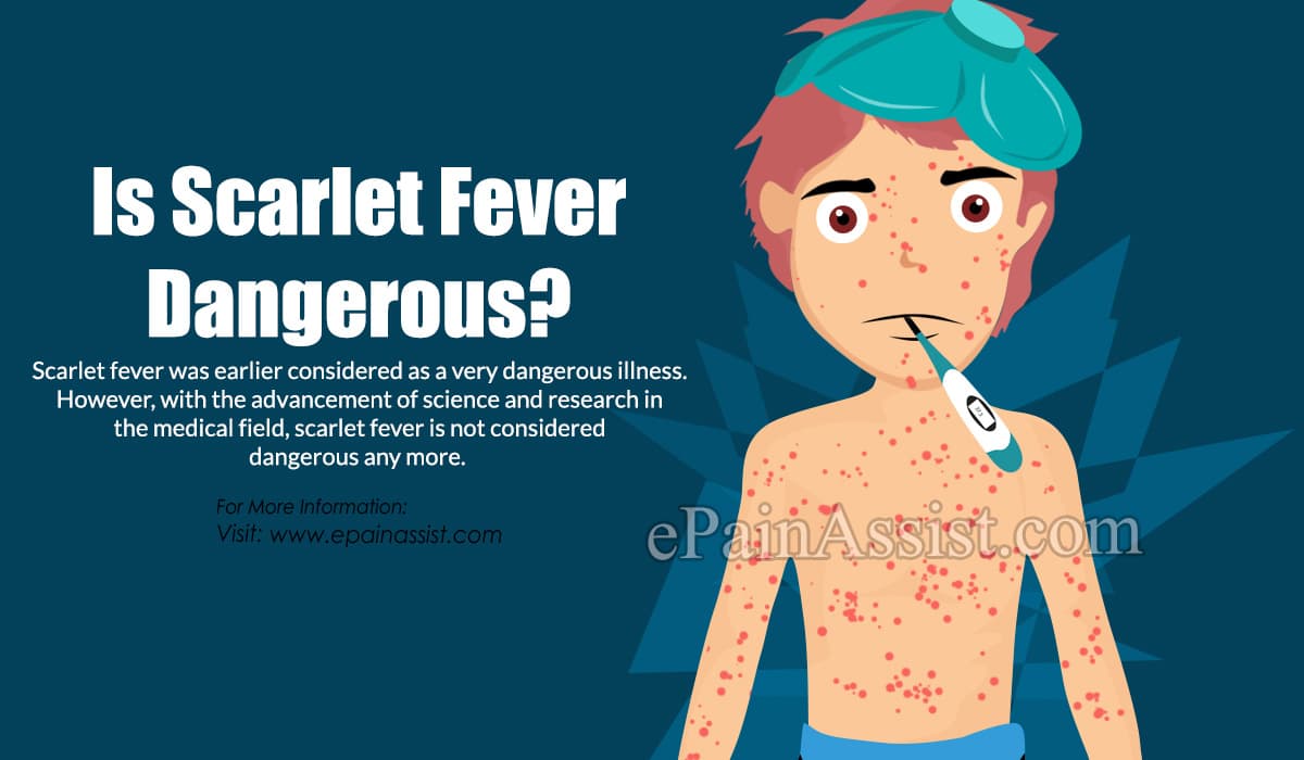 Is Scarlet Fever Dangerous How Long Does Scarlet Fever Last Is Scarlet Fever Dangerous How Long Does Scarlet Fever Last
