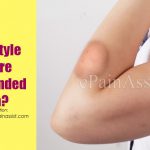 Know What is Skewfoot or Serpentine Foot and its Treatment