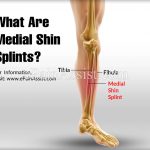 Low Back Pain or Lumbago|Anatomy, Causes, Symptoms, Treatment- PT, Surgery