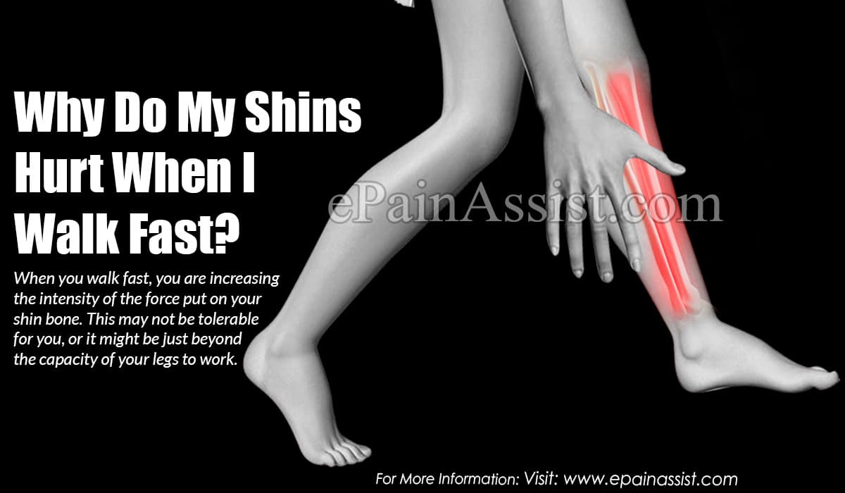 Why Do My Shins Hurt When I Walk Fast 