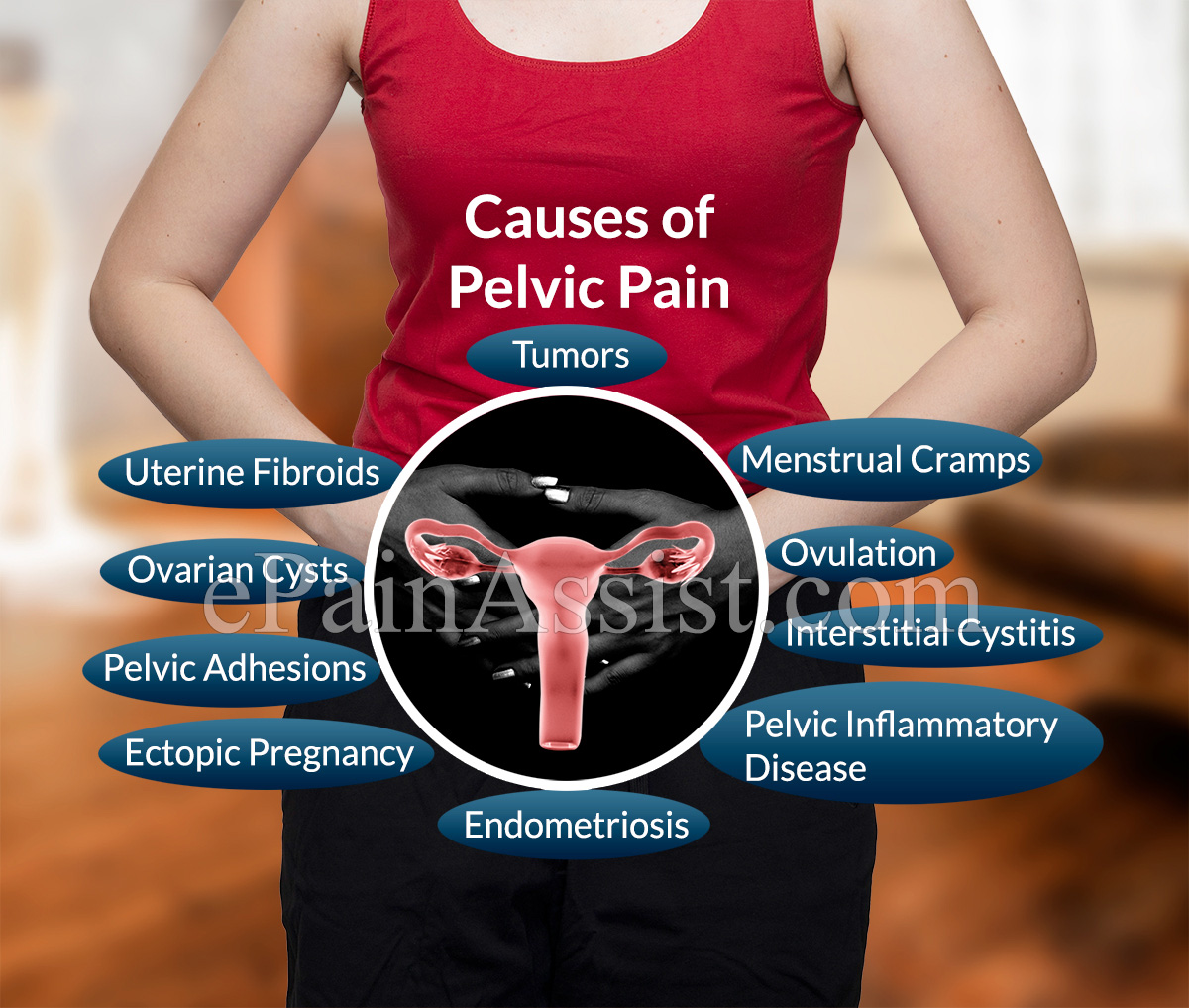 10 Causes Of Pelvic Pain In Females