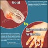 Arthritis Information Center|Fungal|Gonococcal|Juvenile|Psoriatic|Osteoarthritis