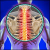 Upper Back Pain Information Center|Forestier's Disease|Torticollis|HNP ...