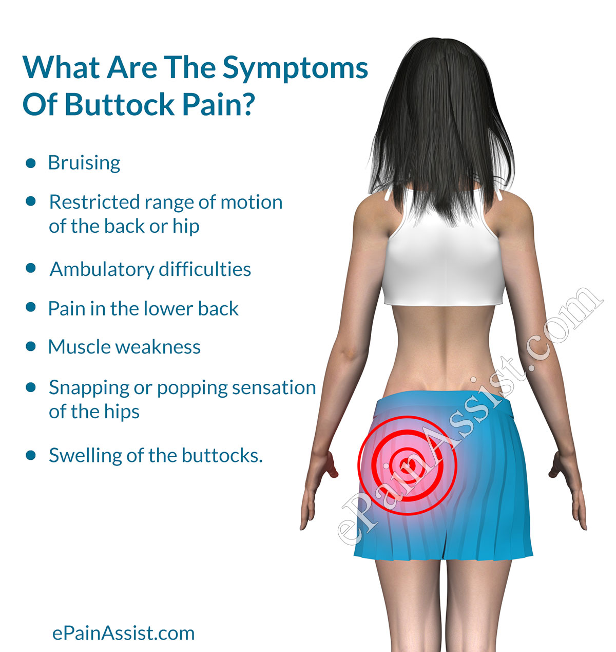 What Can Cause Buttock Pain And How Can It Treated What Can Cause Buttock Pain And How Can It Treated
