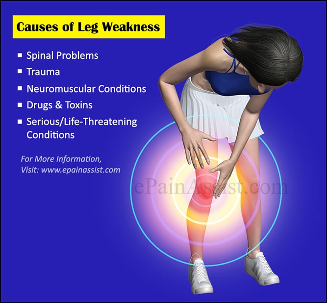 What Causes Leg Weakness How Is It Treated What Causes Leg Weakness How Is It Treated
