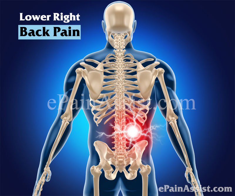 Lower Right Back Pain Causes Symptoms Treatment Lower Right Back Pain Causes Symptoms Treatment