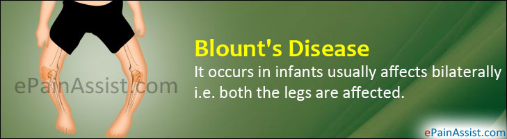 Blount's Disease or Tibia Vara|Treatment|Causes|Symptoms|Classification