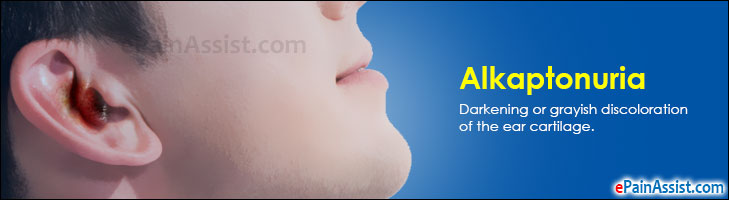 Alkaptonuria: Treatment, Prevention, Symptoms, Causes