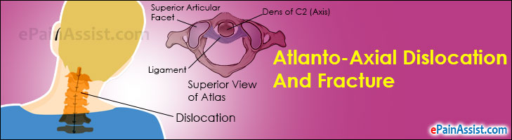Atlanto-Axial Dislocation And Fracture: Causes, Symptoms, Treatment
