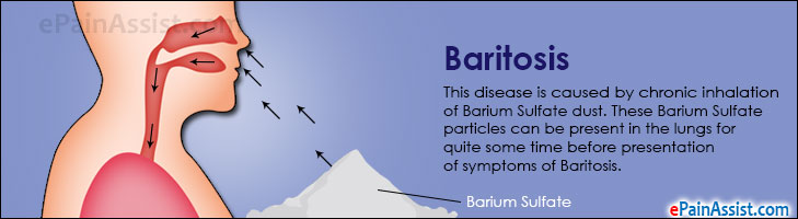 Baritosis: Treatment, Prevention, Causes, Symptoms, Diagnosis