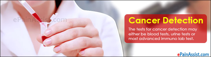 Cancer Detection: Lymphocyte Genomic Sensitivity Test!