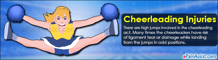 Worst Cheerleading Accidents
